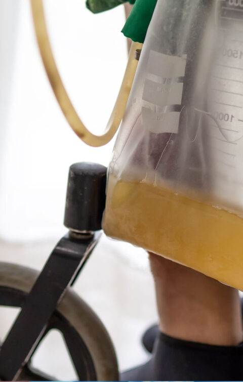 Catheter & Uridome Training for Support Worker - Skills Centre Australia